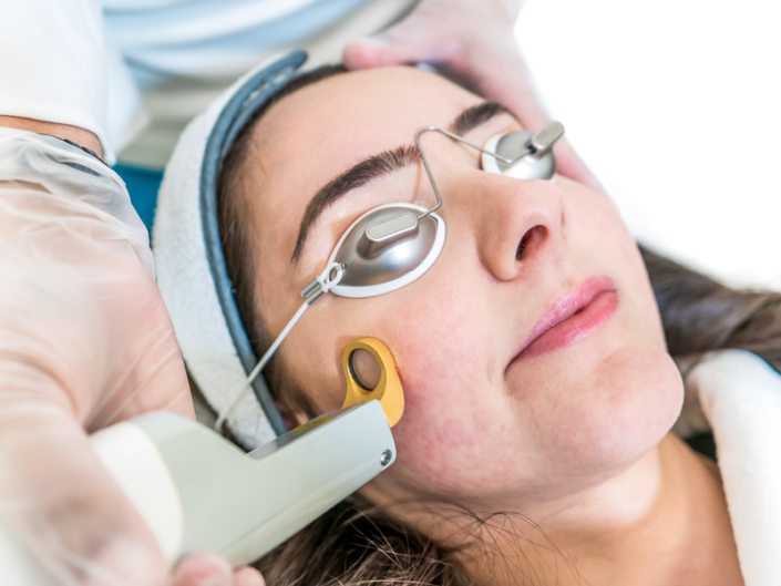 Couperose et rosacée : traitement au laser à Lausanne